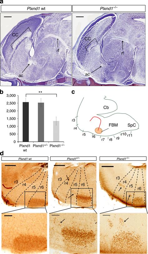 Plxnd1 Mouse Brain Characterization A Paraffin Sagittal Sections Of Download Scientific