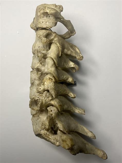 This Is A Real Human Spine Segment I Got From A Closed Museum Rvultureculture This Is A Real Human Spine Segment I Got From A Closed Museum Rvultureculture