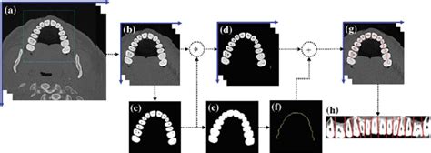 Several Steps Of The Proposed Segmentation Techniques A A Typical Download Scientific Diagram