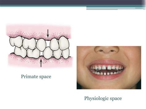Self Correcting Anomalies Pptx