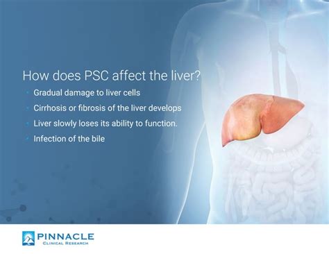 Primary Sclerosing Cholangitis Psc Pdf