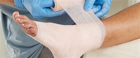 Unna Boot Application Made Easy Achieve Better Wound Outcomes
