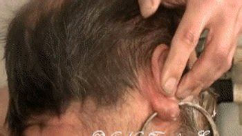 ZIT POPPING Videos And Porn Clips Clips Sale