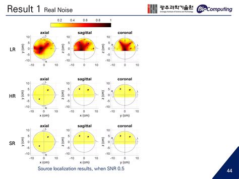 Feasibility Of Eeg Super Resolution Using Deep Convolutional Networks Ppt