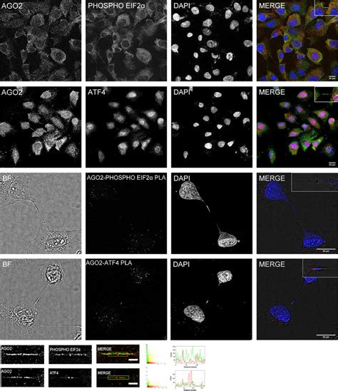 Subcellular Localization And Interaction Between Ago2 And Er Stress