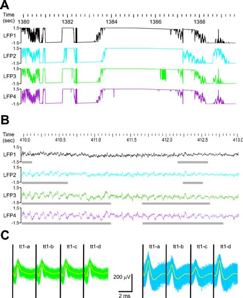 representative local field potentials and single unit spike waveforms