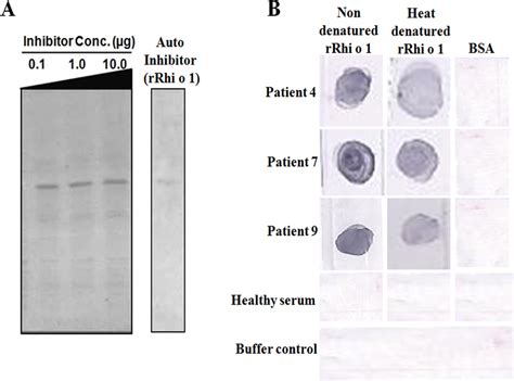 Ige Binding To Denatured Rhi O 1 A Ige Blot Inhibition 5 μg Rrhi O Download Scientific