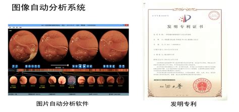 智能胶囊胃镜系统 南方医科大学国家大学科技园
