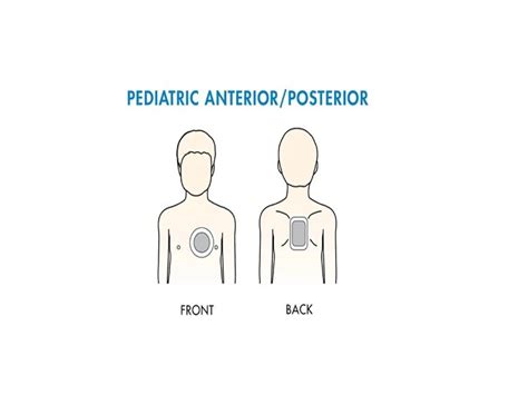 Cardioversion And Defibrillation نذير Pptx