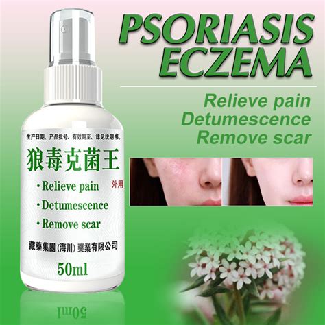 손발 박리 및 갈라짐 건선 피부염 습진 연고 가려움증 방지 의료용 스킨 케어 크림 50g50ml 스킨케어