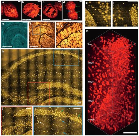 Rong Fan On Linkedin Spatialomics Spatialbiology Histology Pathology Imaging Singlecell