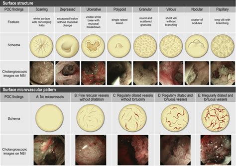 Gie Gastrointestinal Endoscopy Videogie And Igie On Linkedin Il