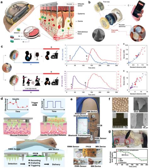 Microneedle Sensors For Point‐of‐care Diagnostics Pmc