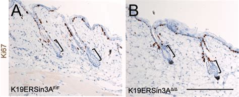 9 loss of sin3a in bulge stem cells does not induce proliferation in