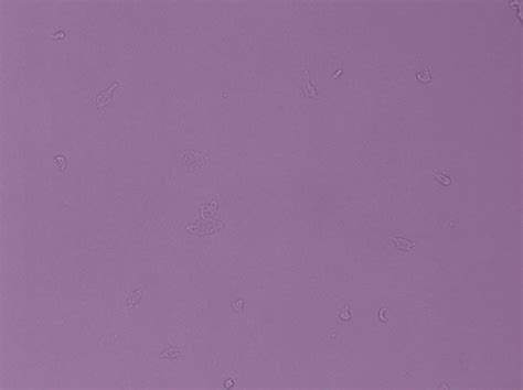 Comparison Of Cell Morphology Before And After Exposure To H2O2 Download Scientific Diagram