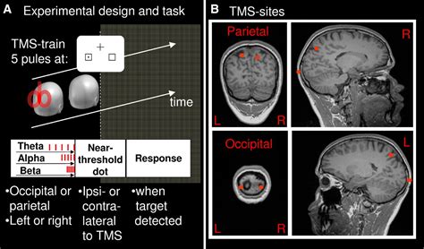 On The Role Of Prestimulus Alpha Rhythms Over Occipito Parietal Areas In Visual Input Regulation