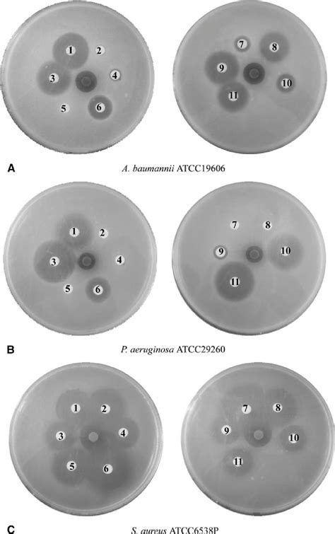 Synergy Test By The Double Disc Diffusion Method For The Diethyl Ether Download Scientific