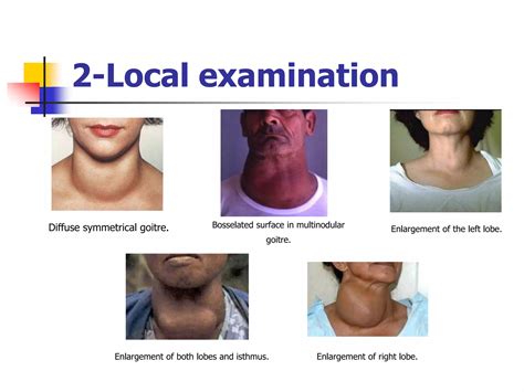Thyroid Case Sheet Ppt