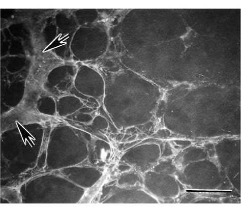 Fibronectin Immunolabeled Retinal Flat Mount From A 1 Dayold Rat