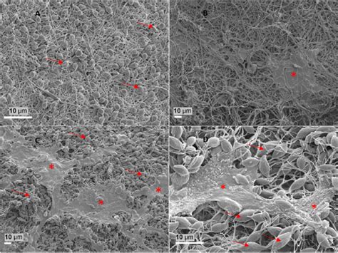 Evaluation Of The Nanofibers Cell Biocompatibility A Pla As A