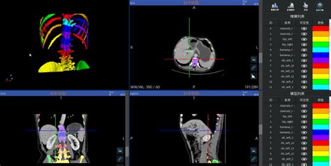 人工智能医学图像处理软件 系统开发 程序员客栈