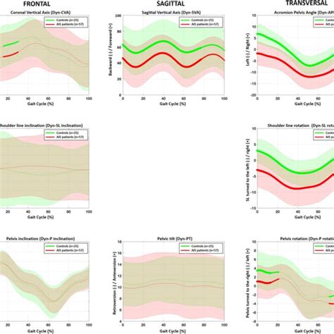 Comparison Of Gait In Transverse Plane Between Ais Patients And Download Scientific Diagram