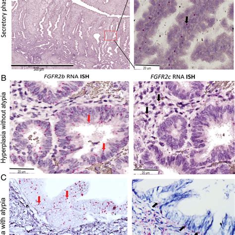 Pattern Of Fgfr2b And Fgfr2c Expression In Representative Normal