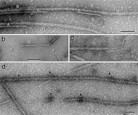 Negative Stain Em And Immuno Em Of Dmt Ribbon And Filament Fractions