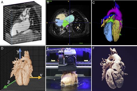Three Dimensional Printed Cardiac Models Applications In The Field Of