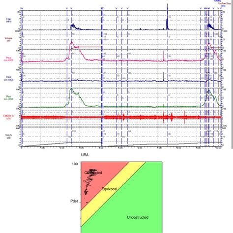 Urocuff Test Comparing High Pves To Low Pves In Two Patients Presenting Download Scientific