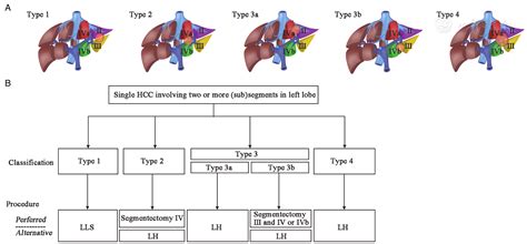 New Classification Oriented Laparoscopic Anatomical Hepatectomy Strategy For Hepatocellular