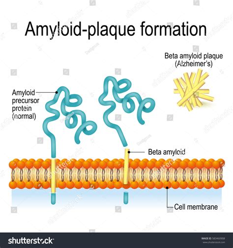 58 Amyloid Beta 스톡 벡터 이미지 및 벡터 아트 Shutterstock