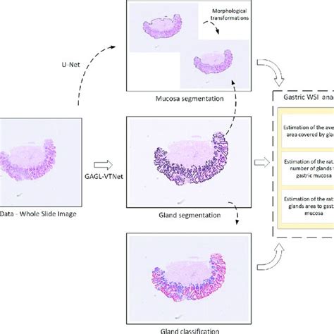 The Proposed Framework For Gastric Gland Segmentation Classification