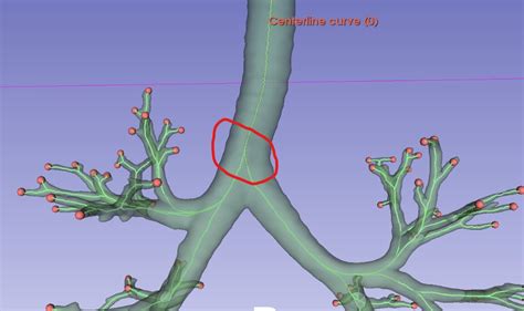 Vmtk Generated Centerline Curves Missing Structure Hierarchy Support