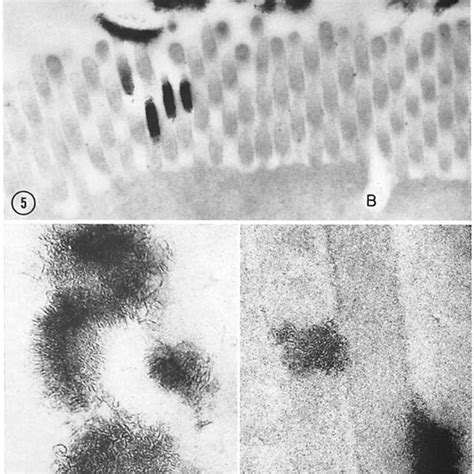 Intestinal Brush Border With Localized Lanthanum Staining Arrow
