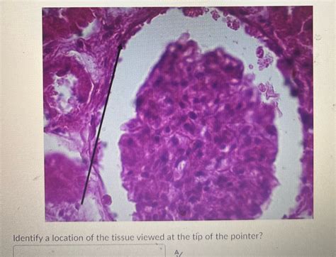 [solved] identify a location of the tissue viewed at the tip of the