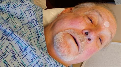 Ulcer Inside R Ankle Cellulitis R Leg Diabetes Youtube