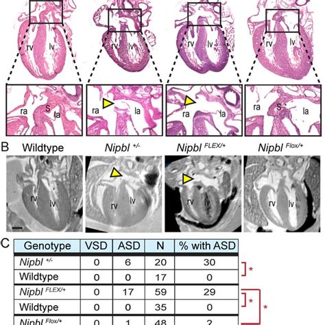 Nipbl Flex And Nipbl Mice Develop Heart Defects At The Same High Download Scientific
