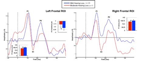 Group Averaged Veps Of Frontal Cortical Rois Average Vep Waveforms In