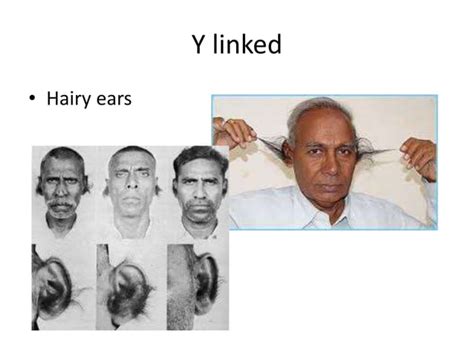 Sex Linked Inheritance And Pedigree Analysisppt
