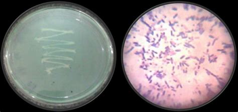 Isolation And Identification Of Bacillus Sr1 A Growth Of Isolated Download Scientific Diagram