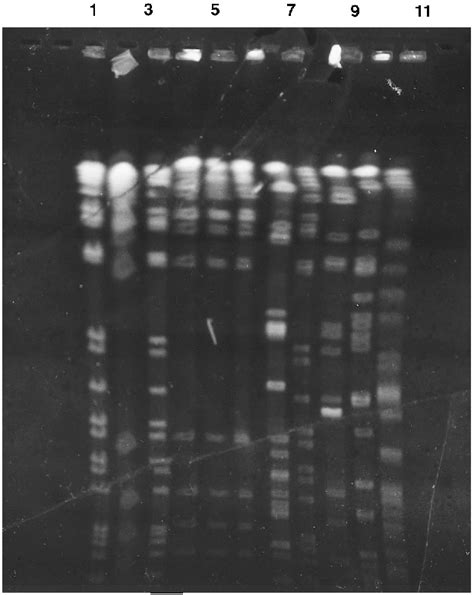Figure 2 From An Epidemiological Study Of Staphylococcus Intermedius