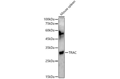 Anti Tcr Alpha Antibody A305341