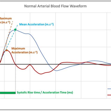 Proposal Of Standardized Measurements For Acceleration Time Or
