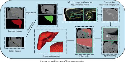 Figure 1 From Gabor Dictionary Of Sparse Image Patches Selected In Prior Boundaries For 3d Liver