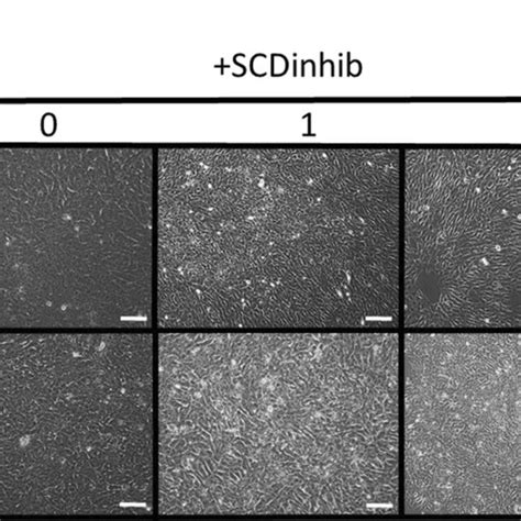 The Phase Contrast Appearance Of Differentiated Pluripotent Stem Cells