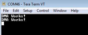STM UART DMA Receive Transmit DMA Rx Tx Examples