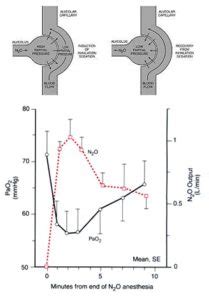 Concentration Effect Second Gas Effect And Diffusion Hypoxia Epomedicine