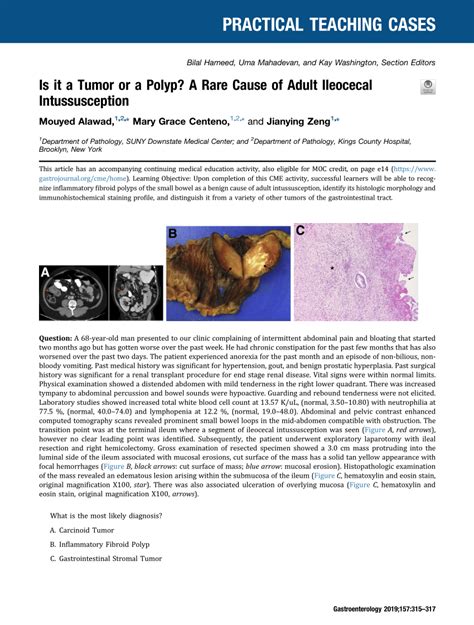 Pdf Is It A Tumor Or A Polyp A Rare Cause Of Adult Ileocecal