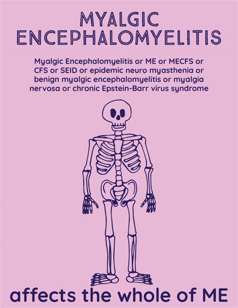 Alisha Whittam On Linkedin Understanding Myalgic Encephalomyelitis A